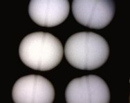 Pearl Xrays | Pearl Education - Pearl-Guide.com